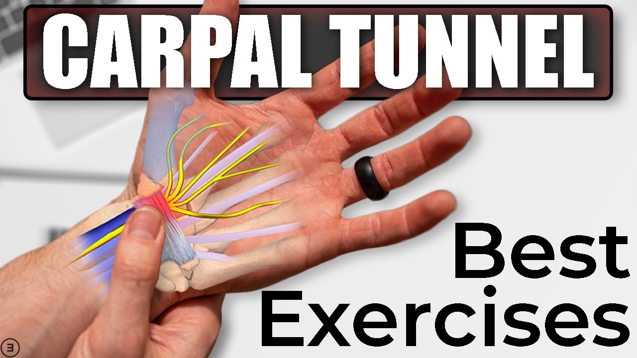 Carpal Tunnel Syndrome Causes Symptoms Treatment