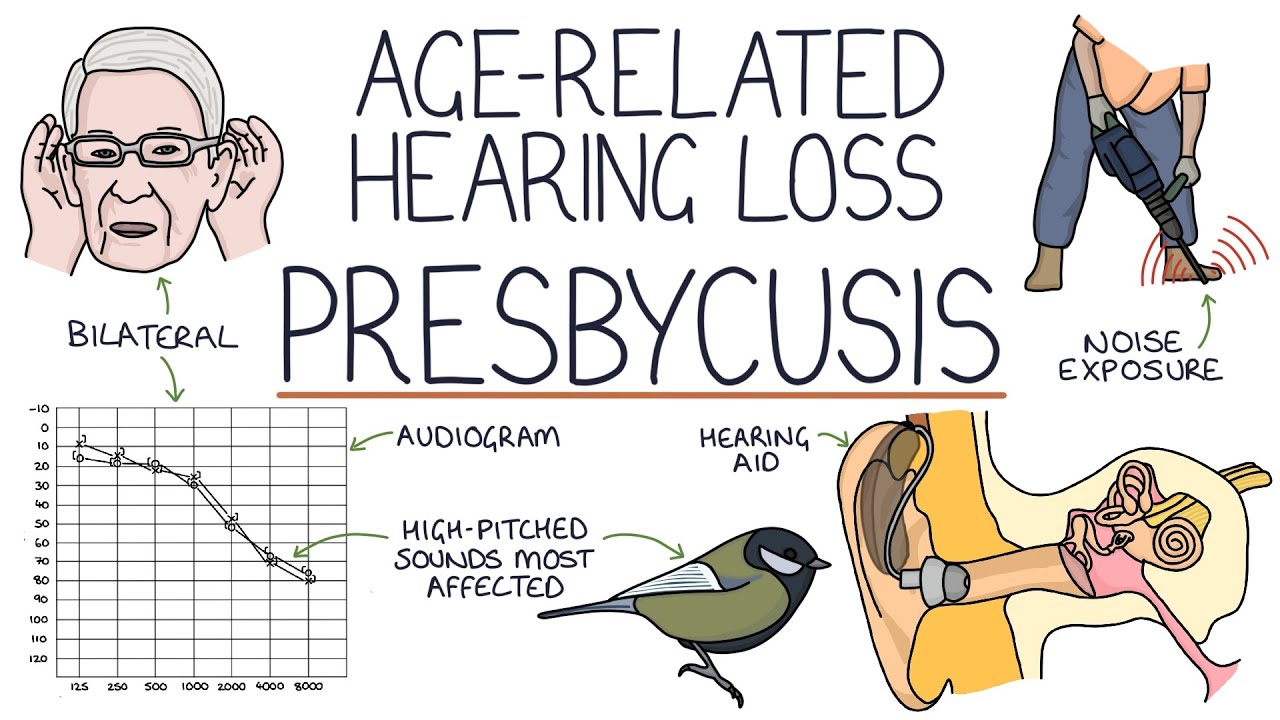 Understanding Presbycusis Age Related Hearing Loss Youtube