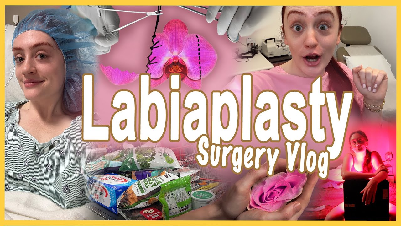 Surgery Vlog My Labiaplasty Journey Youtube