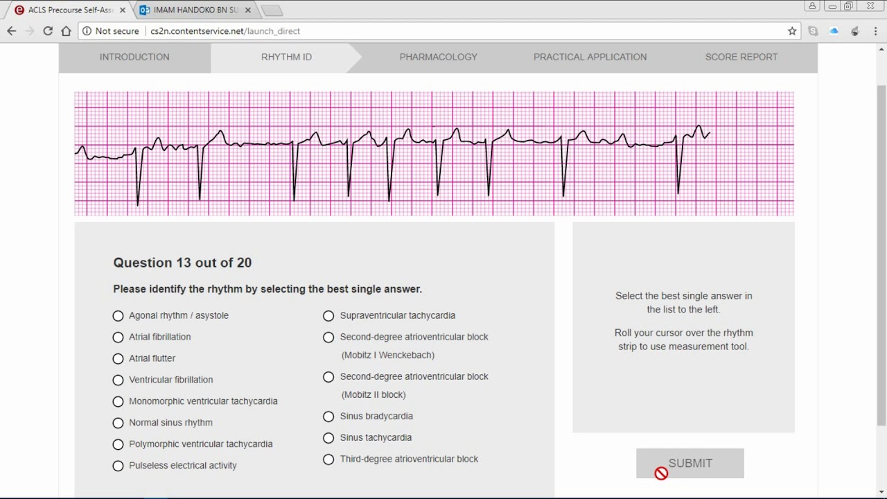 Acls Precourse Self Assessment Rhythm Identification Hotsell Www