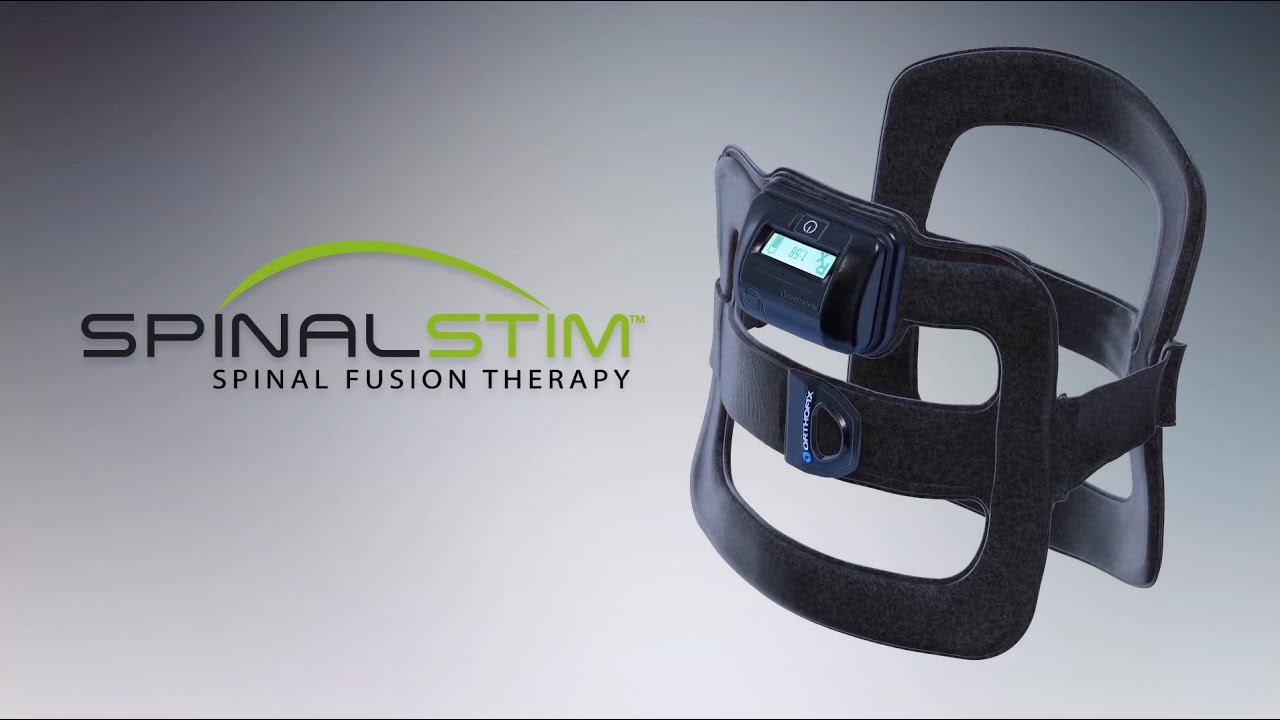 The Orthofix Spinalstim邃 Device Youtube