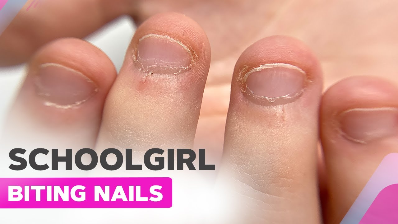 Extremely Bitten Nails Manicure For A Schoolgirl Youtube