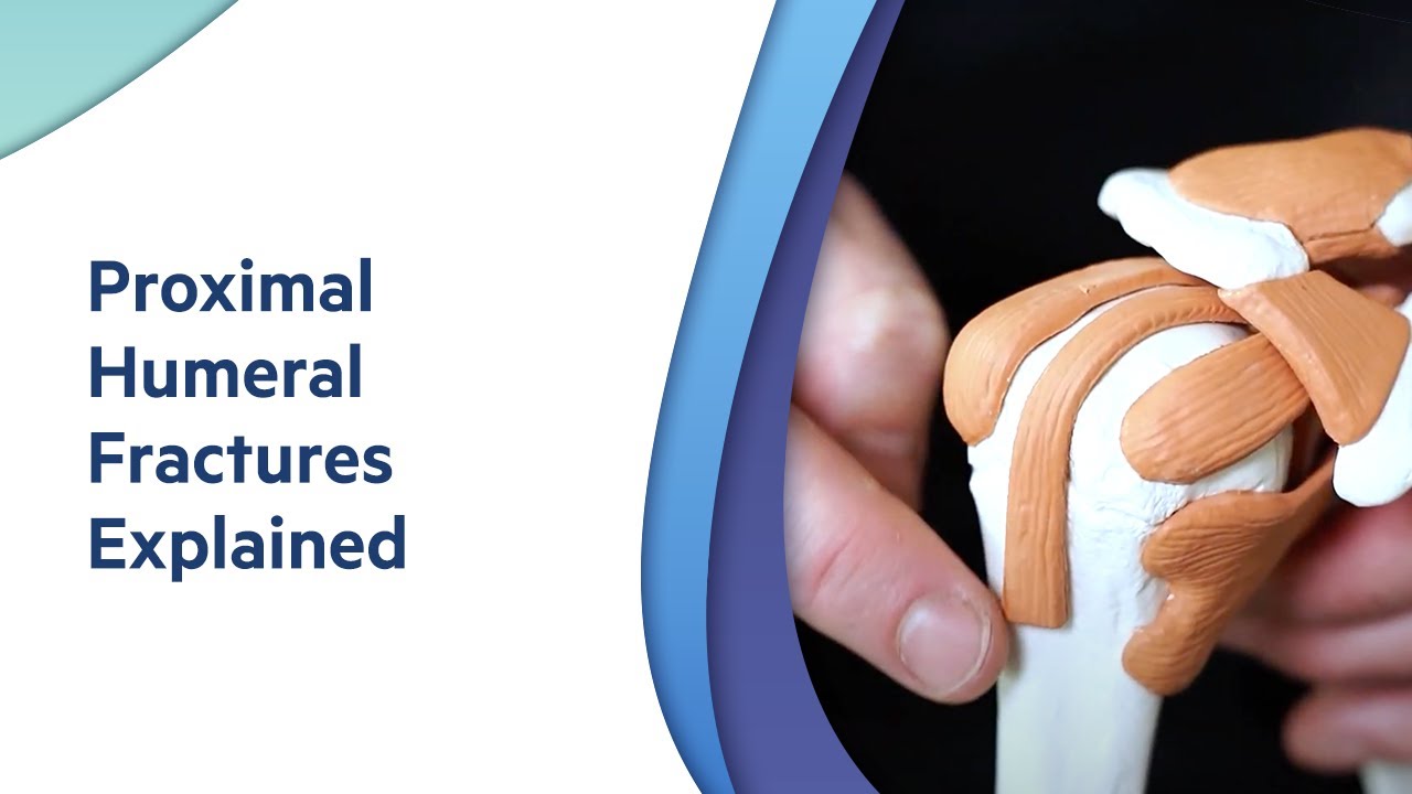 Proximal Humeral Fractures Explained By Adelaide Orthopaedic Surgeon