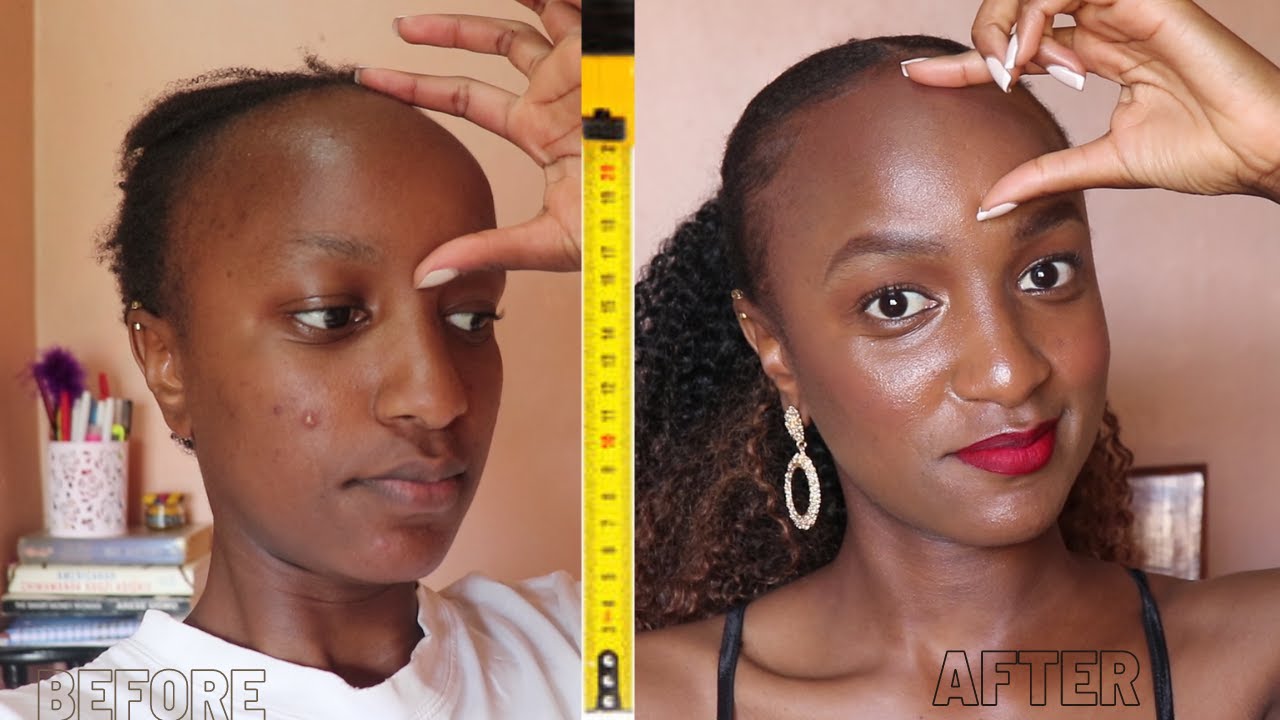 Big Forehead Tiktok Is All About Embracing The Space 41 Off