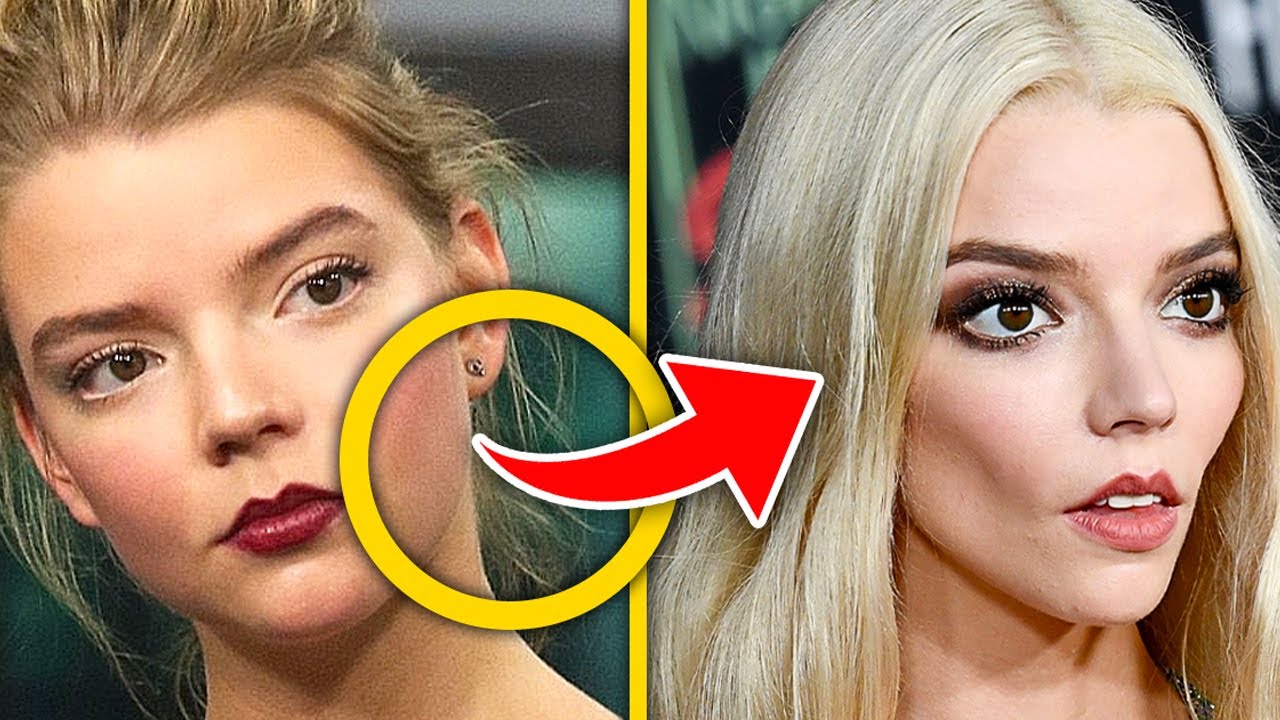 Botched Celebrity Plastic Surgery Jobs That Ruined Their Careers Youtube
