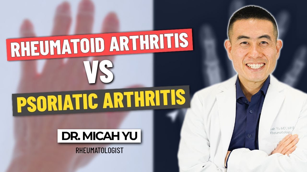 Rheumatoid Arthritis Ra Vs Psoriatic Arthritis Pa Rheumatologist