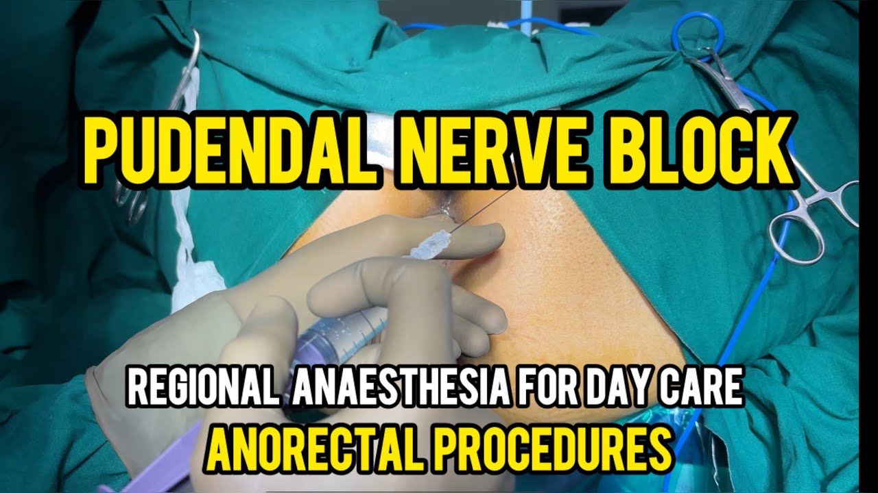 Pudendal Nerve Block Regional Anaesthesia Nerve Block Day Care