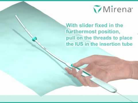 Mirena Ius Insertion Procedure Animated Youtube