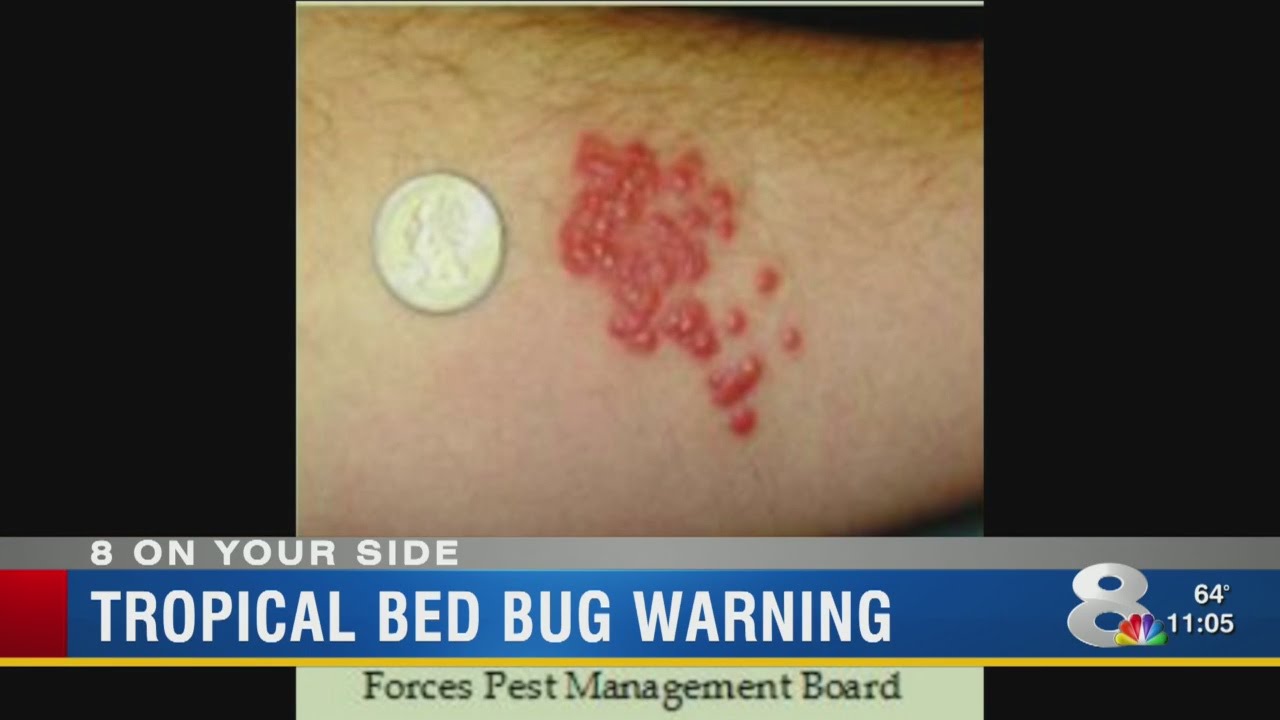 Tropical Bed Bugs Emerge After 60 Years Youtube