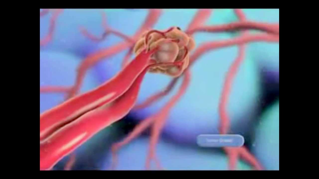 Animation Cancer Youtube