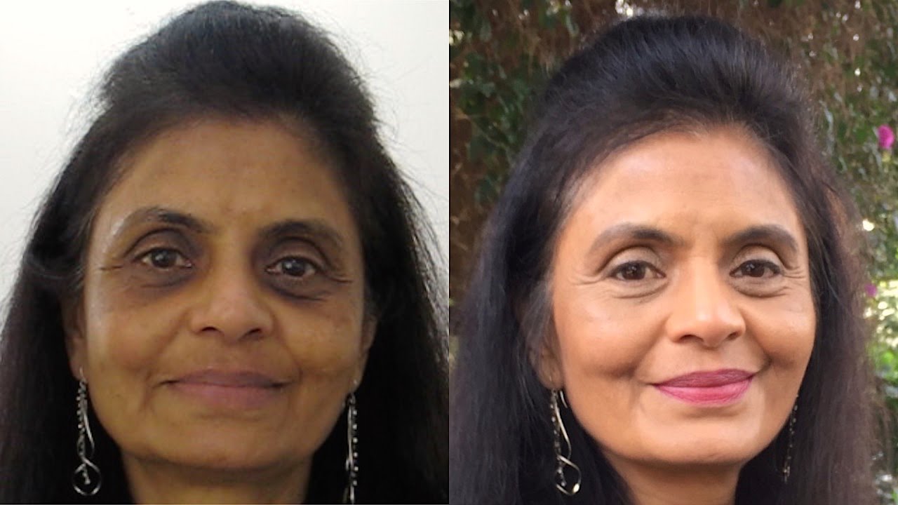 How To Cover Dark Circles Hyperpigmentation Indian Tan Skin Youtube