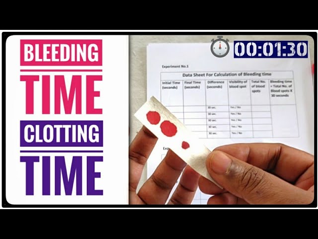 Bt Ct Test Bleeding Time And Clotting Time Coagulation 55 Off