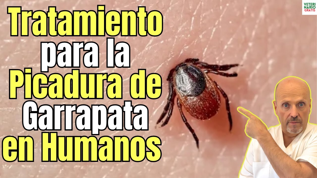 рџљё Picadura De Garrapata En Humanos Tratamiento Mгѓs Efectivo рџљё Youtube