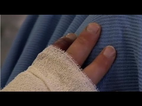 Snake Bite Part 2 Bizarre Er Youtube