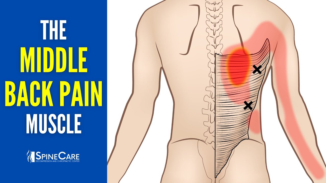 The 3 Middle Back Pain Muscles How To Target Them For Instant Relief