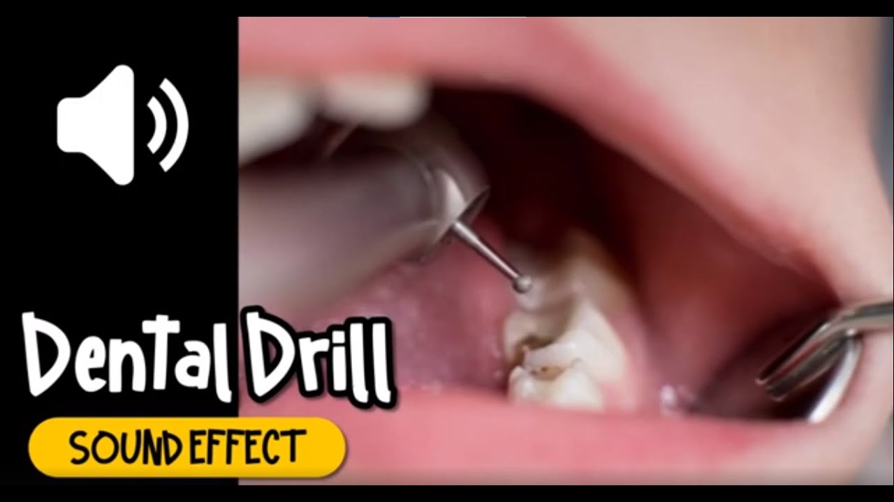Dentist Drill Sound In Ear At Vincent Miller Blog