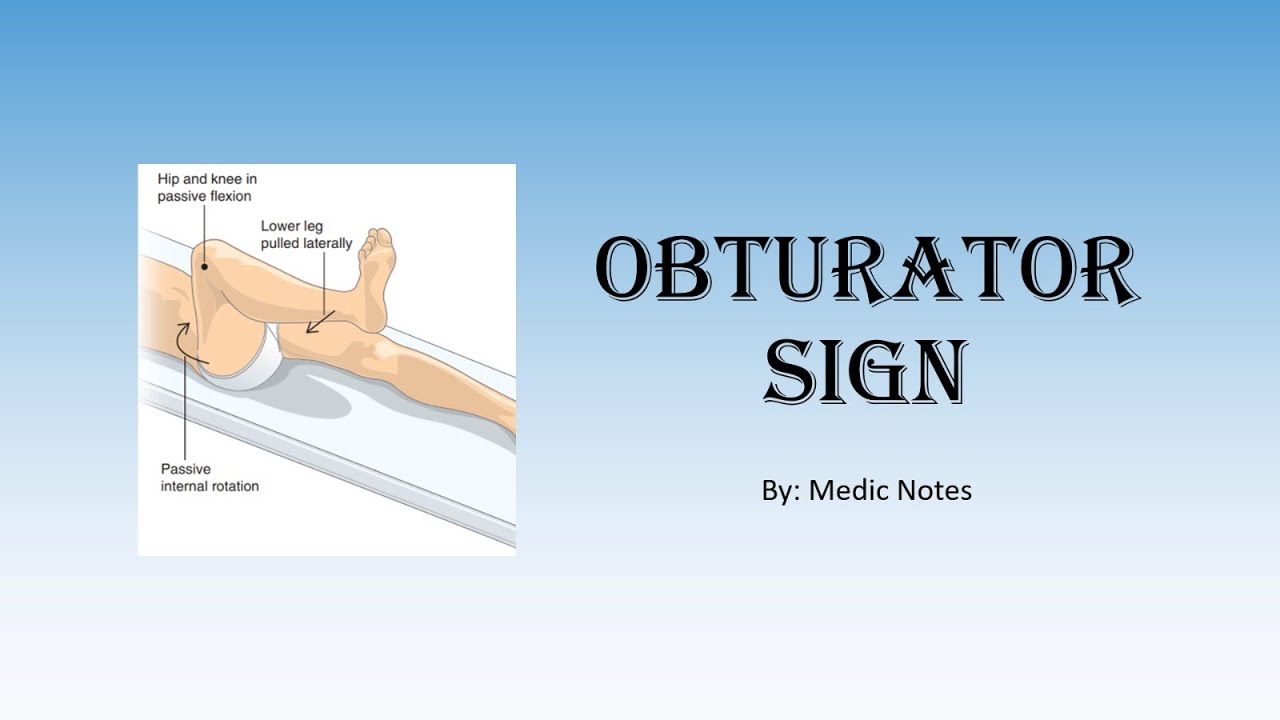 Obturator Groove