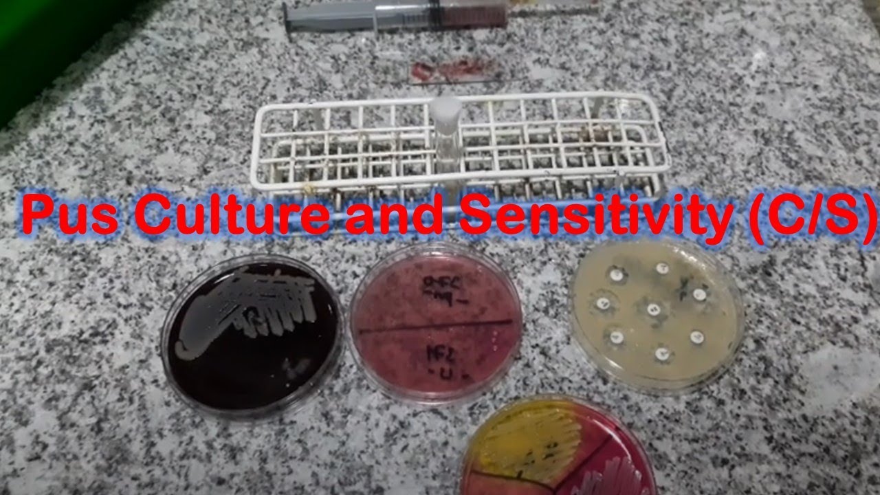 Staphylococcus Aureus Isolation From Pus Culture And Antibiotics
