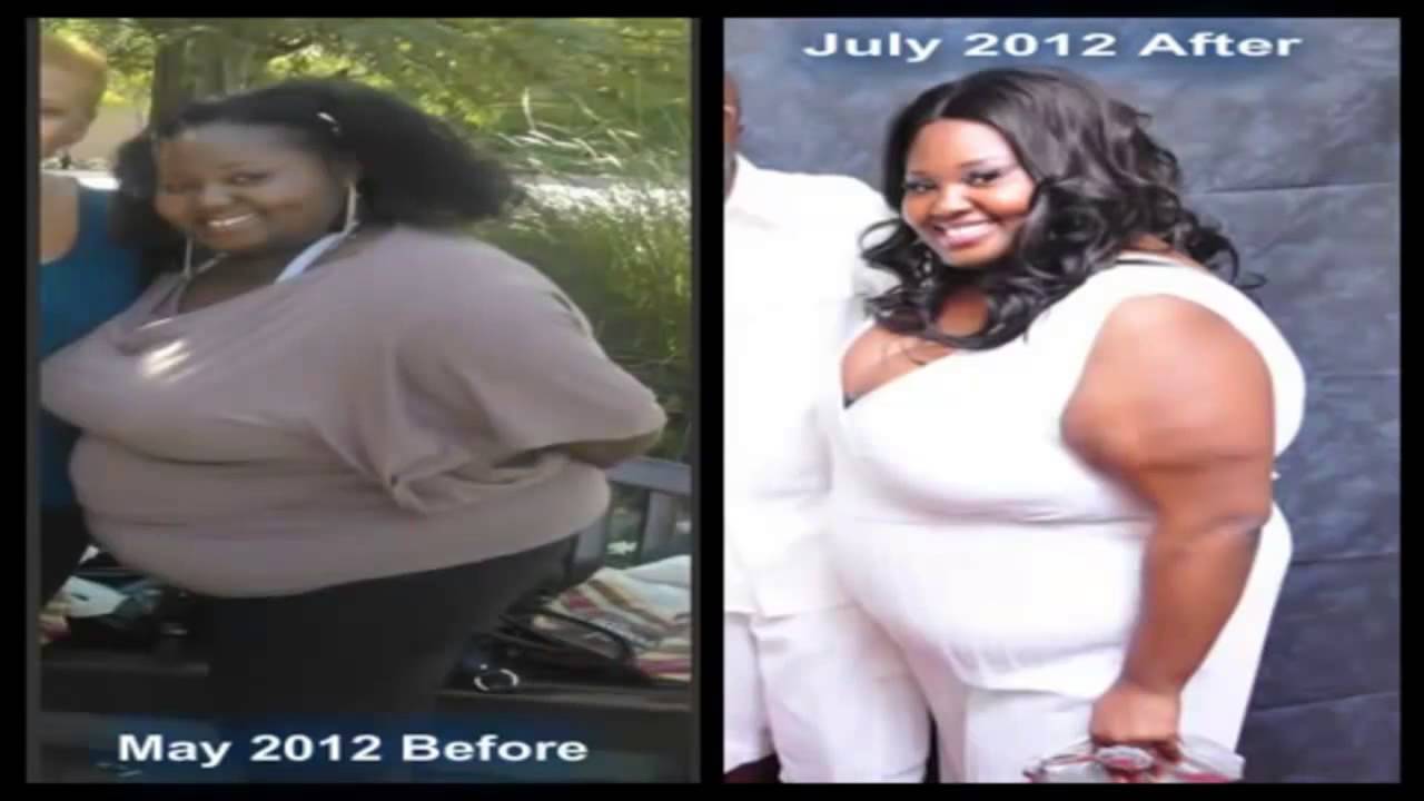 Definition Of Morbid Obesity Help With Obesity Youtube