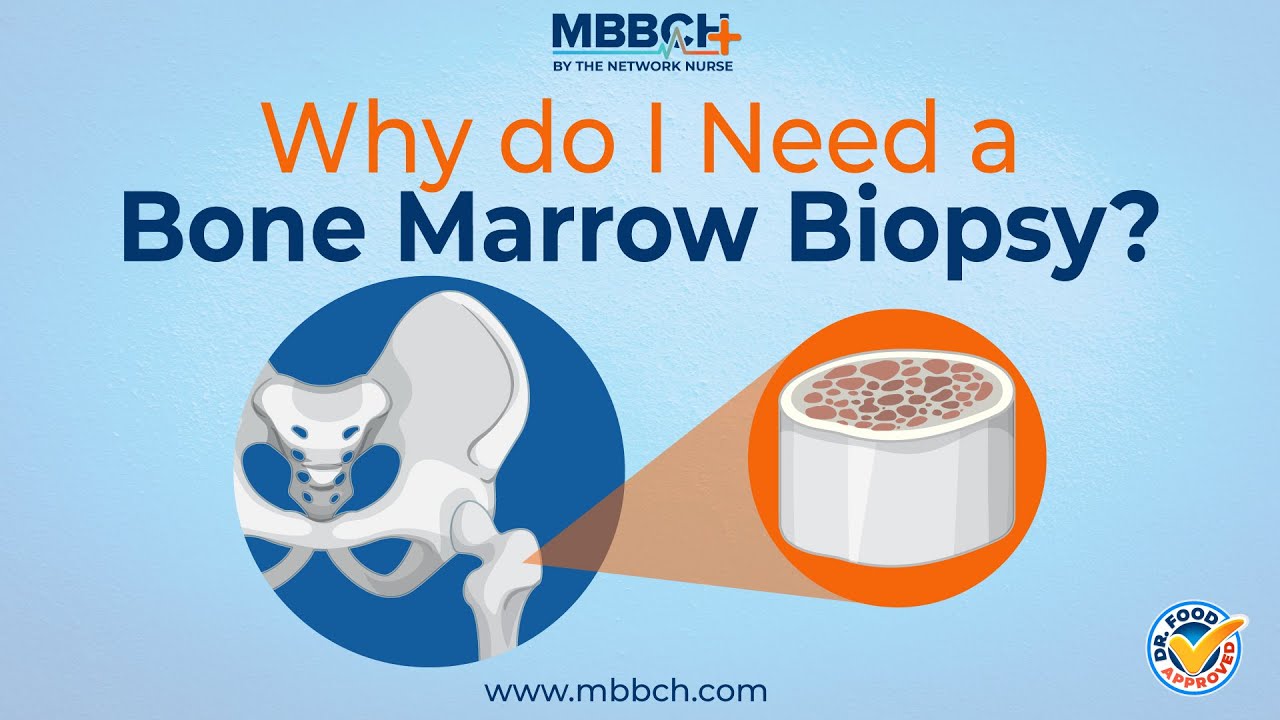 Why Do I Need A Bone Marrow Biopsy I Mbbch Youtube