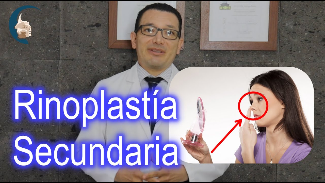 Rinoplastia Secundaria Plasticfacial Mx Youtube