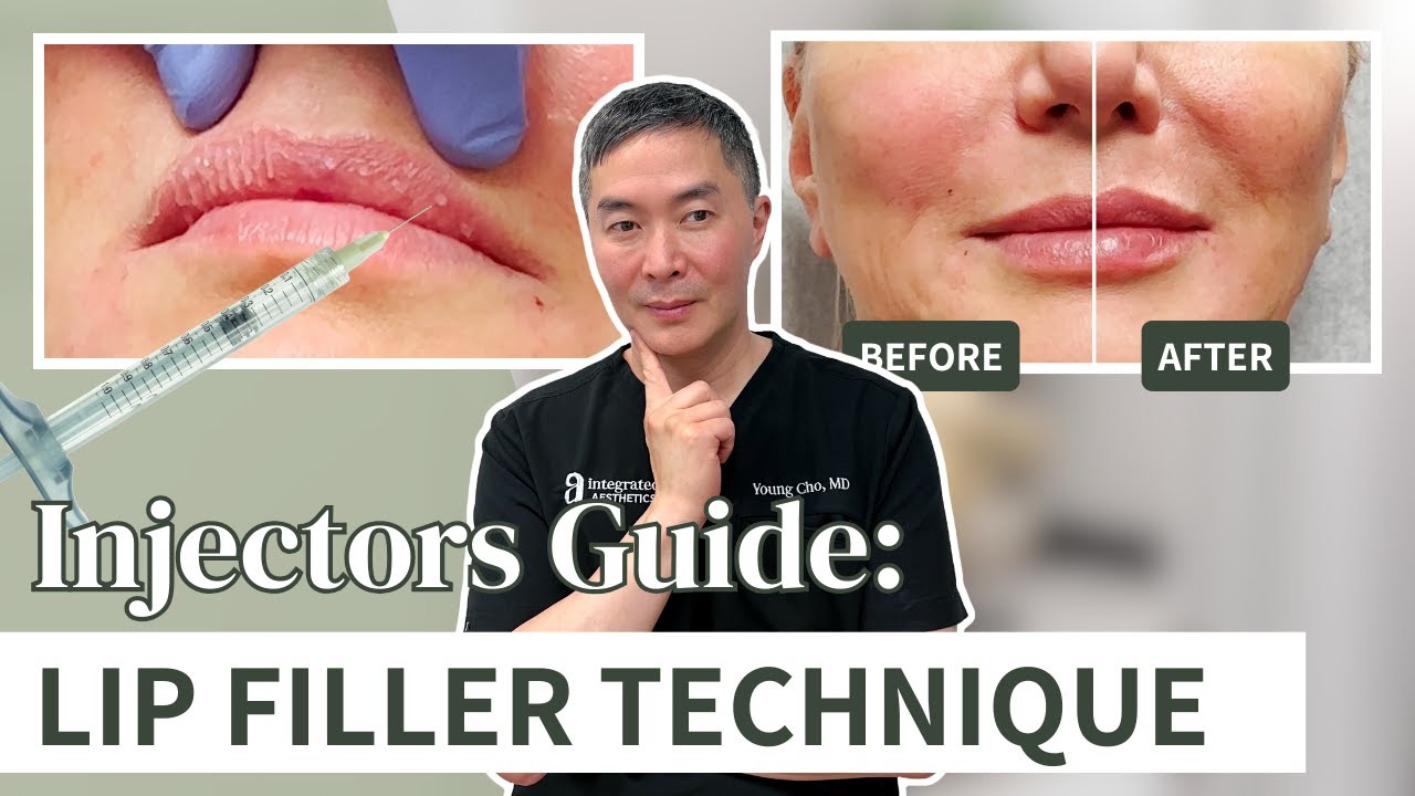 How To Create Beautiful Lips With Dermal Fillers Injector S Guide