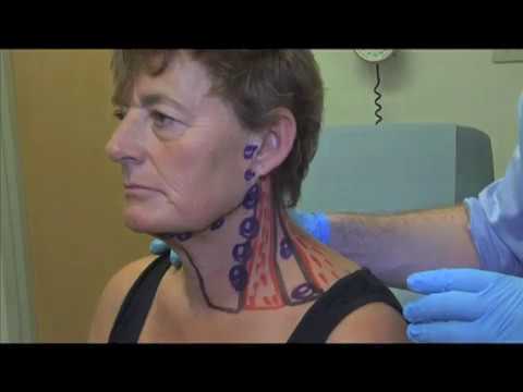 Cervical Lymph Node Examination Youtube