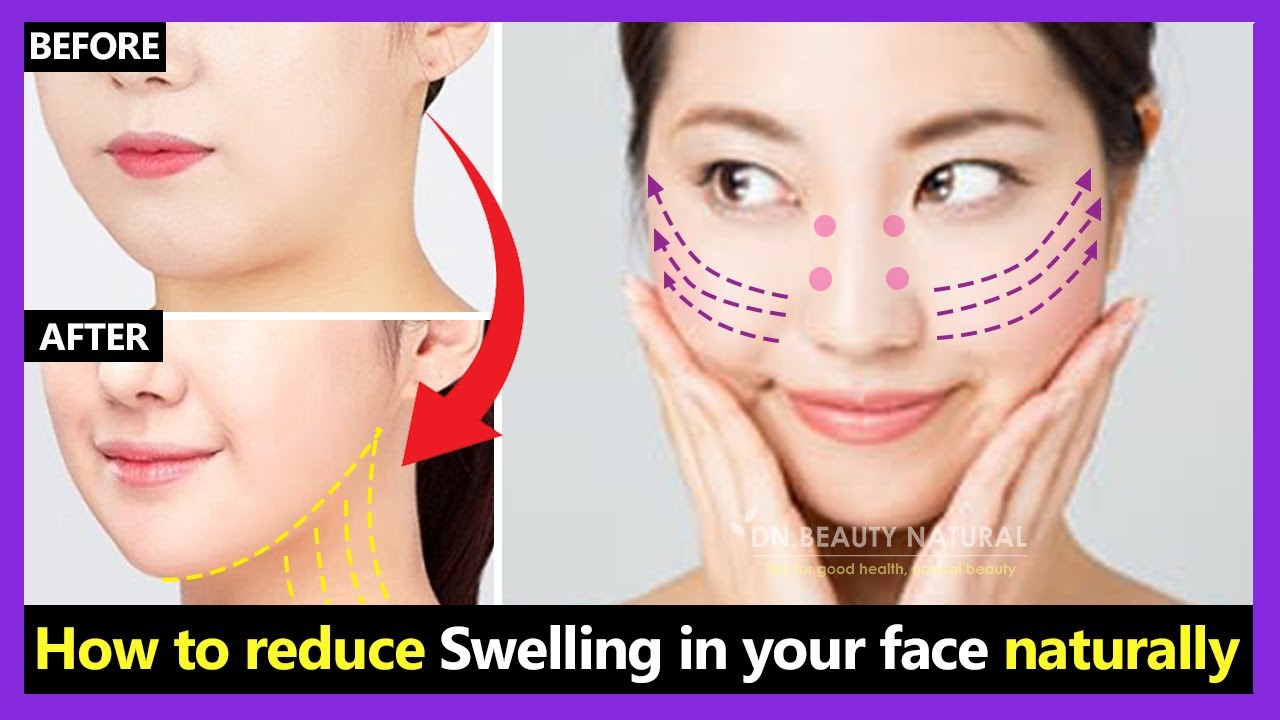 Simple Info About How To Reduce Swelling Face Petertrade29