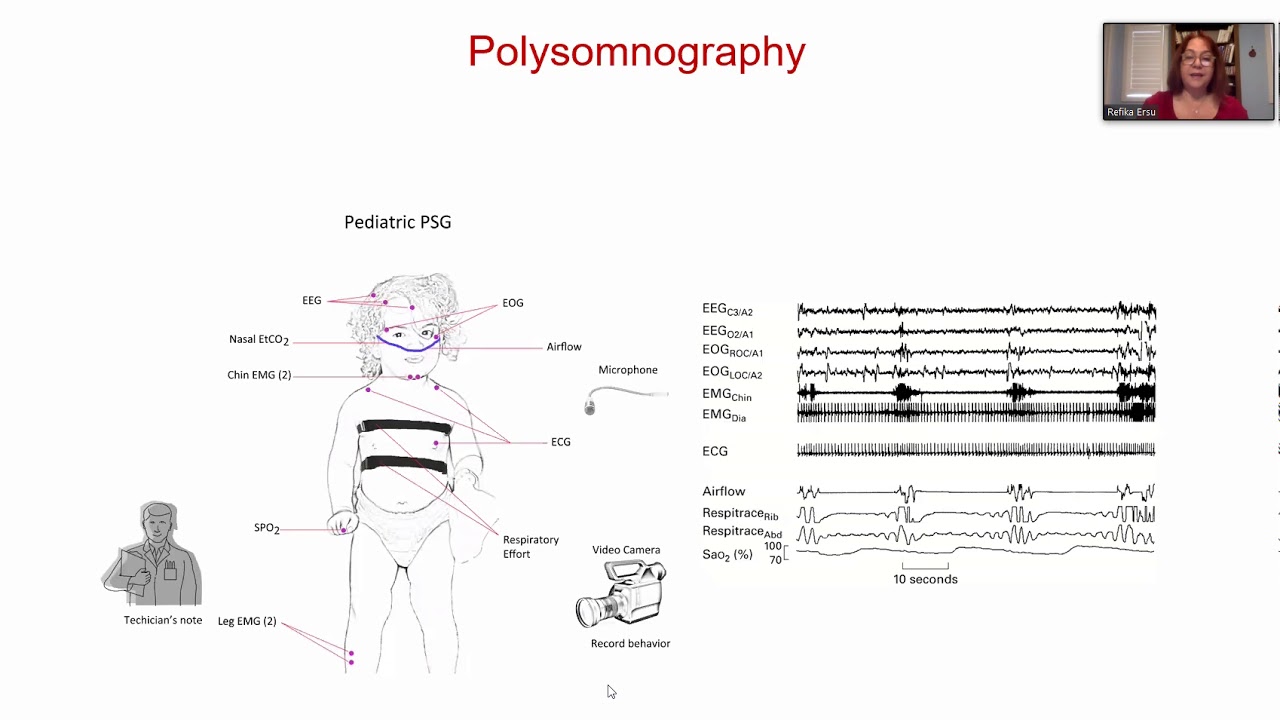 Polysomnography By Dr Refika Ersu Youtube