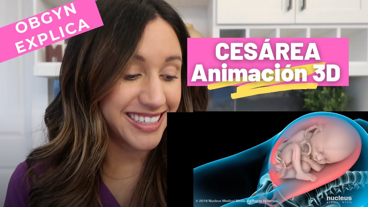 Cesárea Animación 3d Doctora Explica Youtube