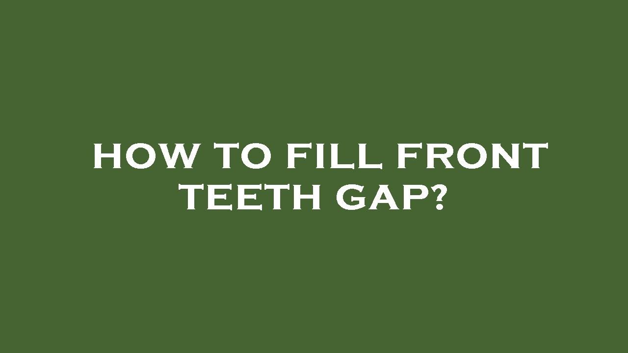 How To Fill Front Teeth Gap Youtube