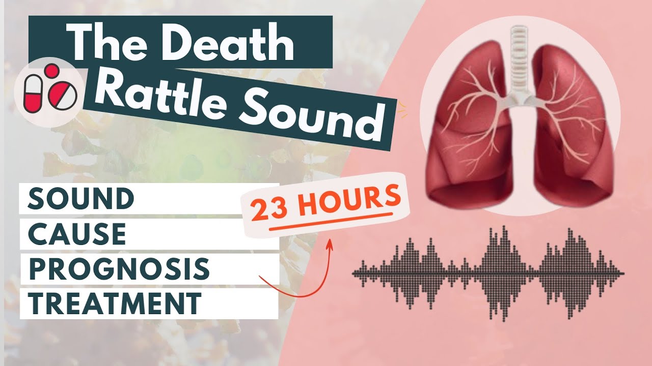 What Does The Death Rattle Sound Like Signs Of Approaching Death