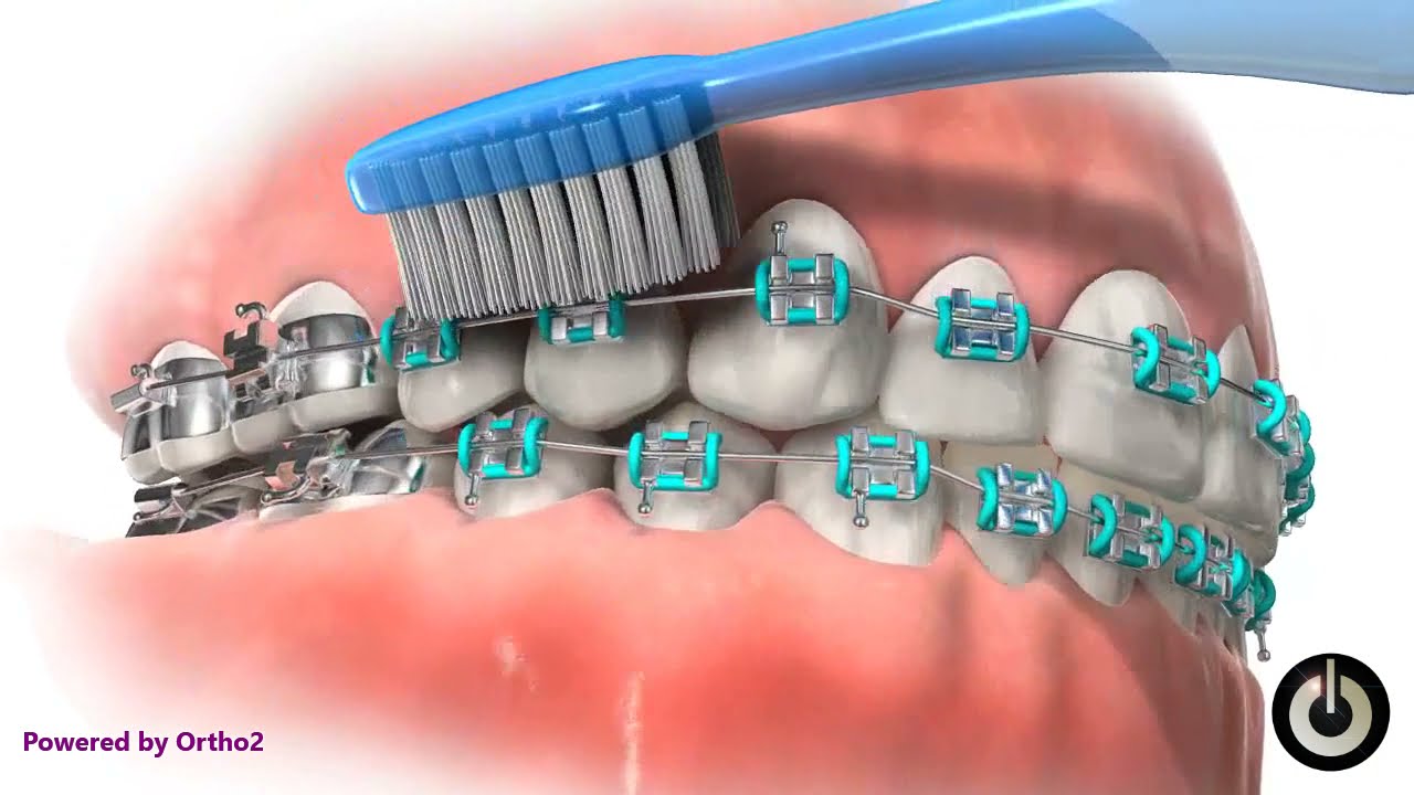 Proper Brushing Technique Youtube