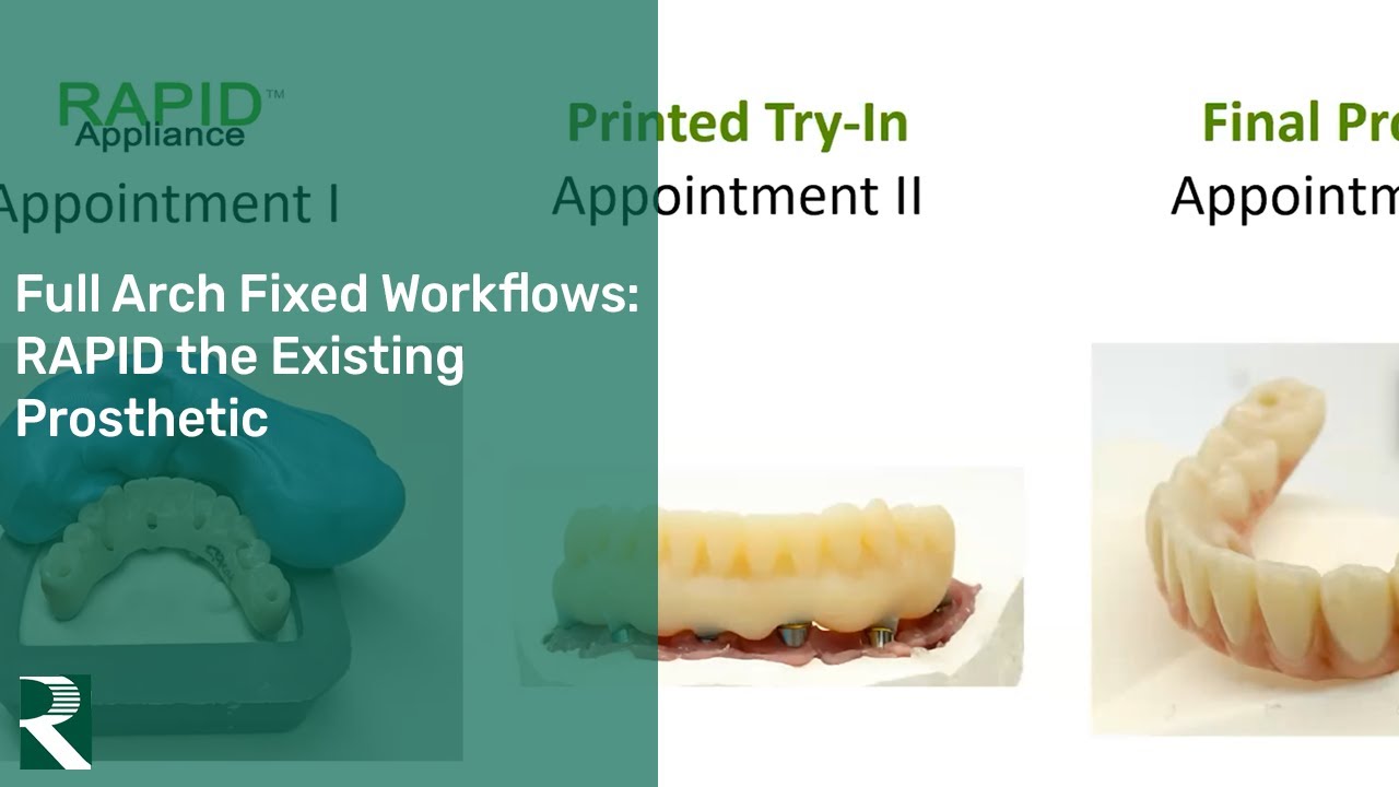 Fixed Full Arch Workflows Rapid The Existing Prosthetic Youtube