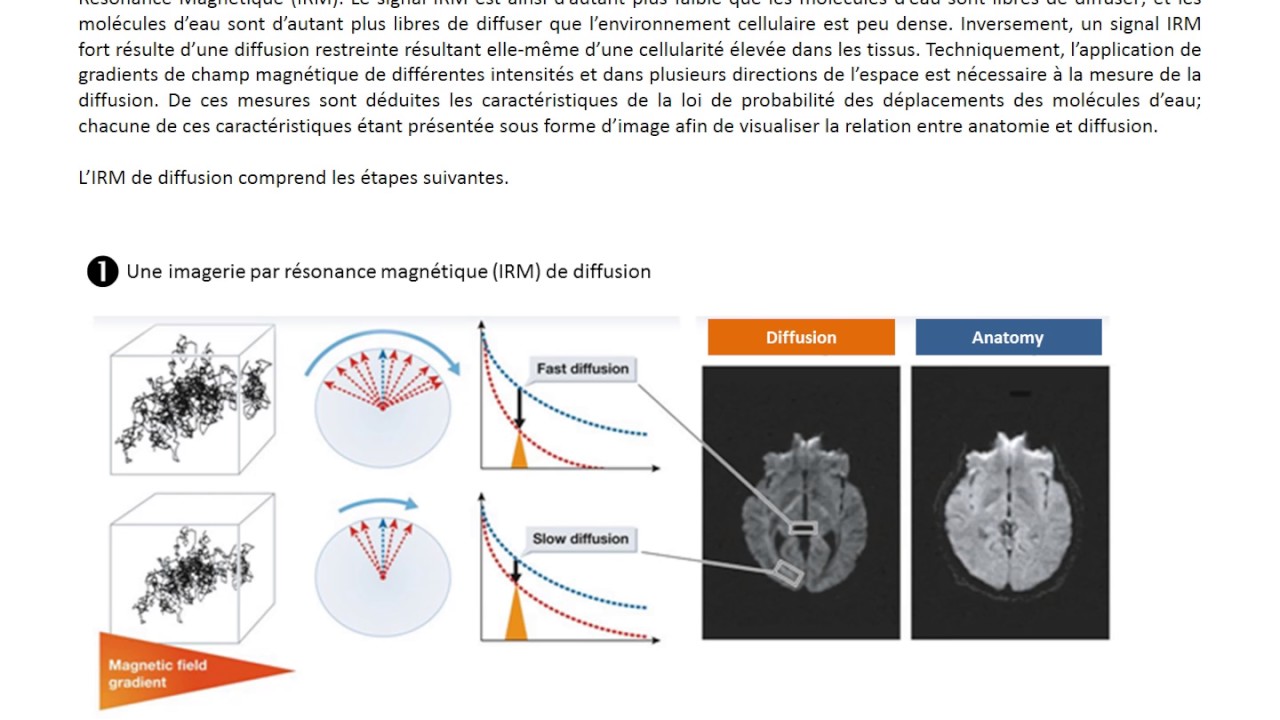 Irm Diffusion Youtube