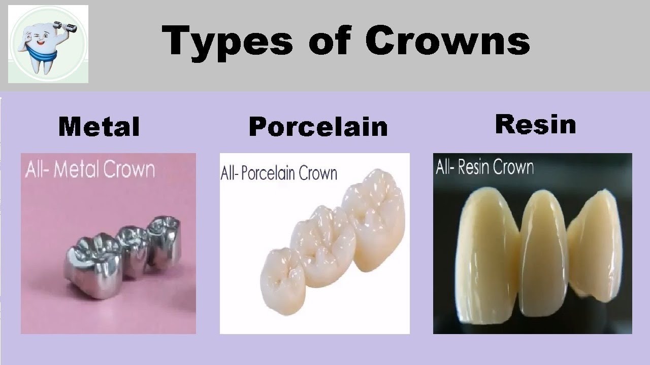 Types Of Dental Caps Crowns Youtube