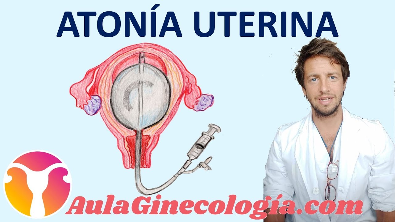 O Que é Atonia Uterina Retoedu