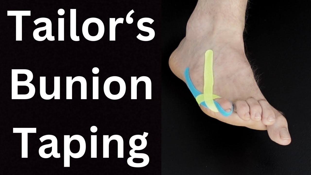 Tailors Bunion Pain Relief Taping Youtube