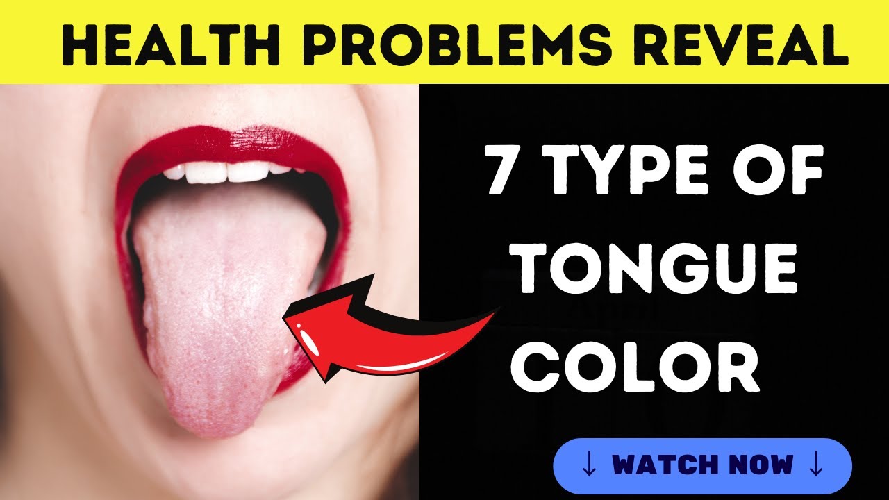 7 Colors Your Tongue Reveal About Your Health Know The Symptoms And