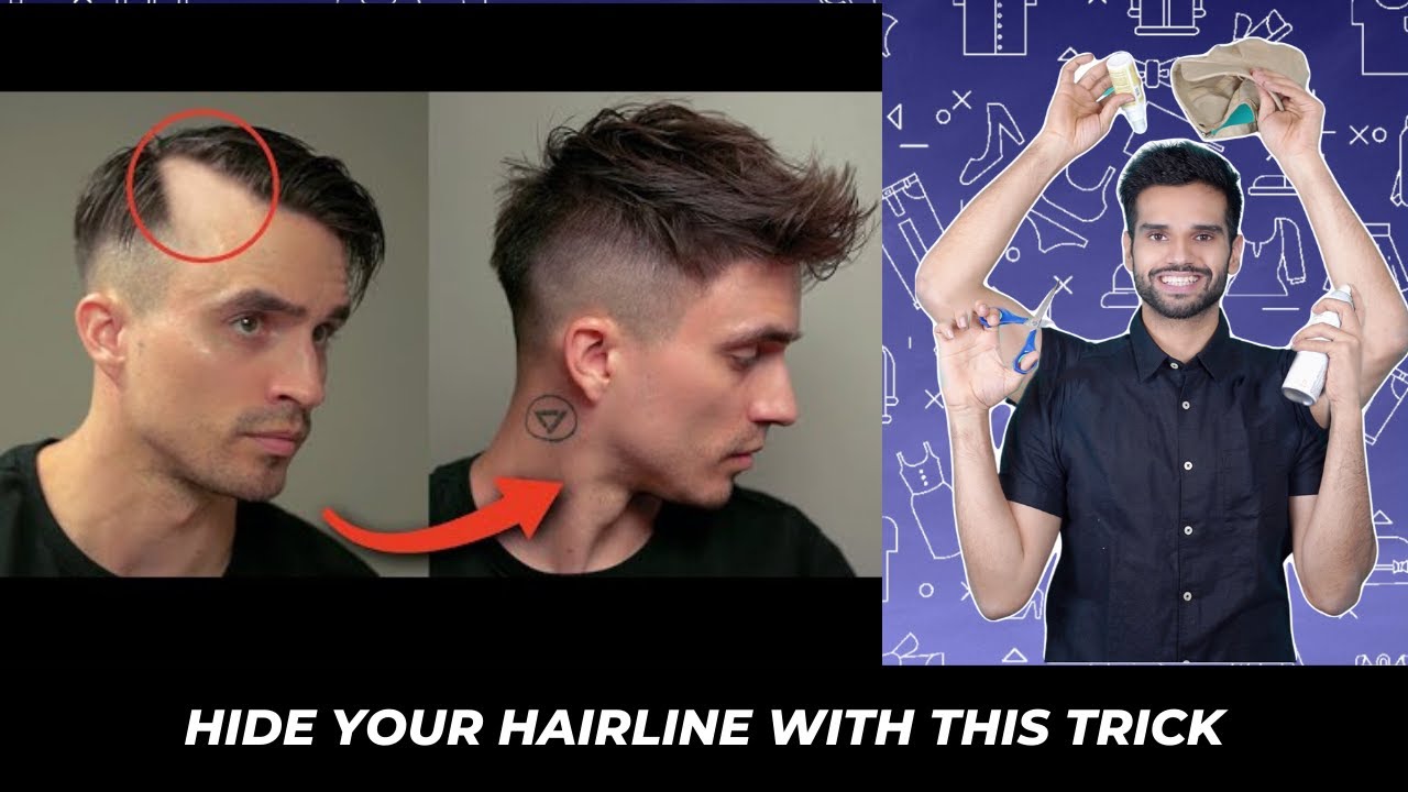 How To Hide Your Hairline Beyourbest Beyourbestofficial Youtube