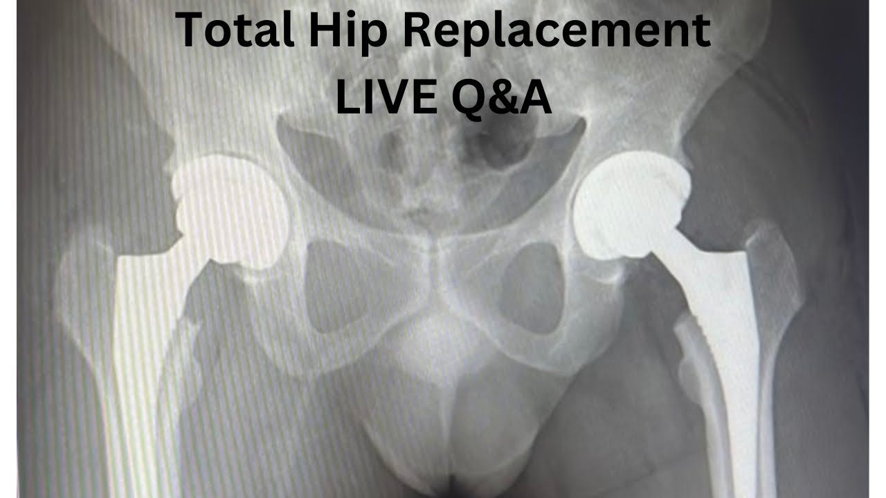 Total Hip Replacement Live Q A With Dr Pankaj Walecha