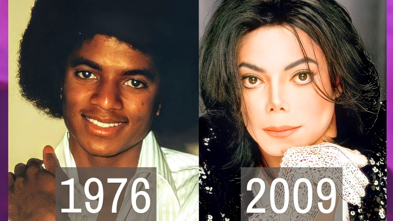 La Nariz De Michael Jackson Antes Y Después La Impactante