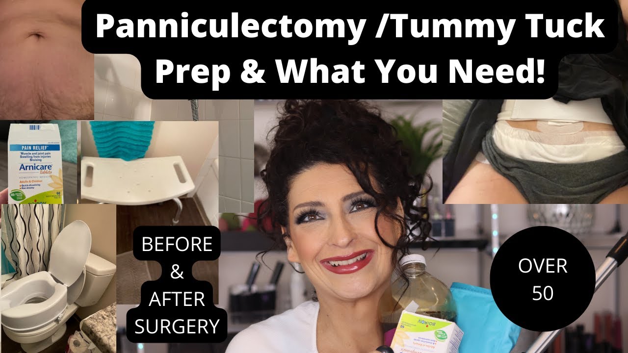 Panniculectomy Tummy Tuck What You Need Know Before After Over