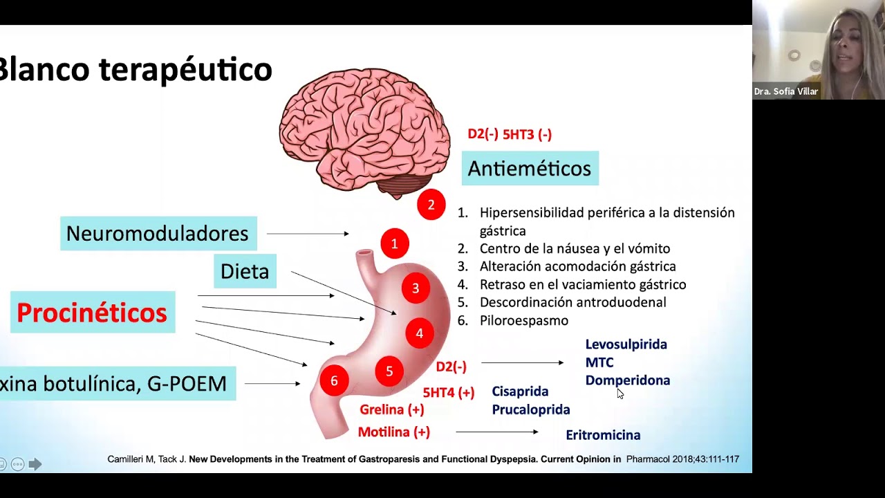 Procinéticos En Gastroparesia Youtube