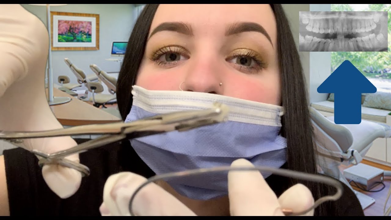 Asmr Applying Your Braces Youtube