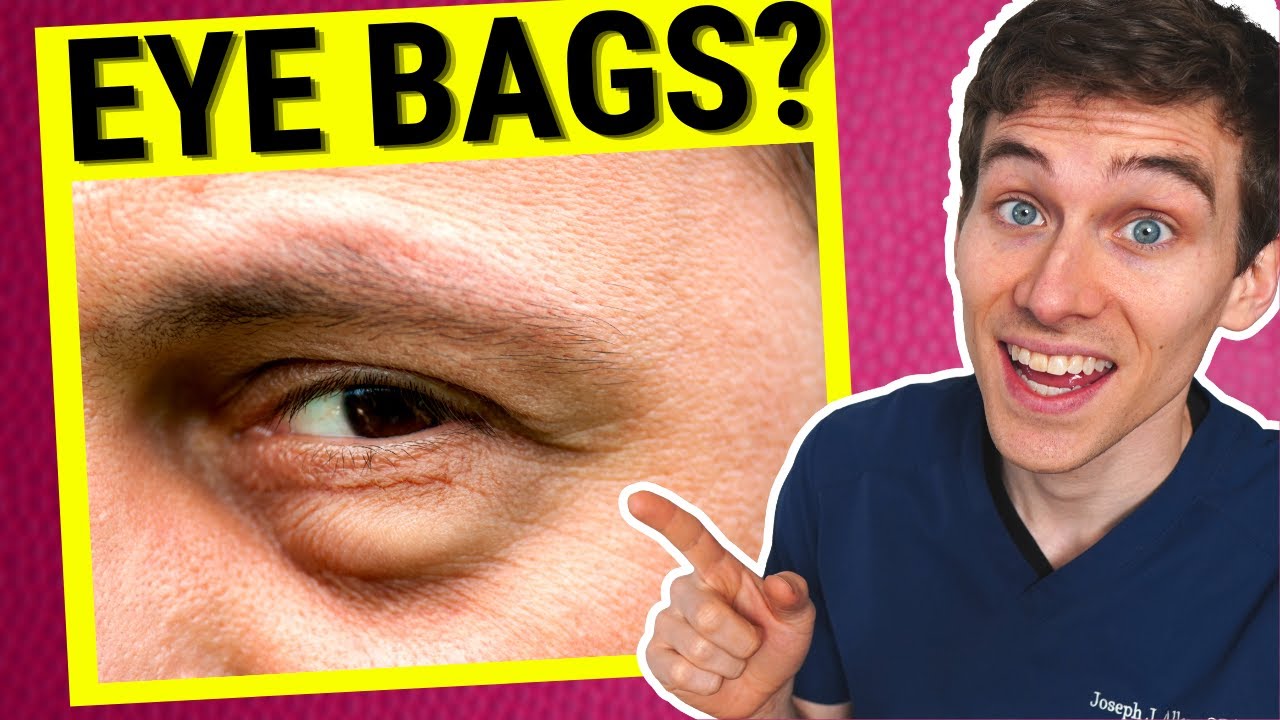 Remove Under Eye Bags Without Surgery