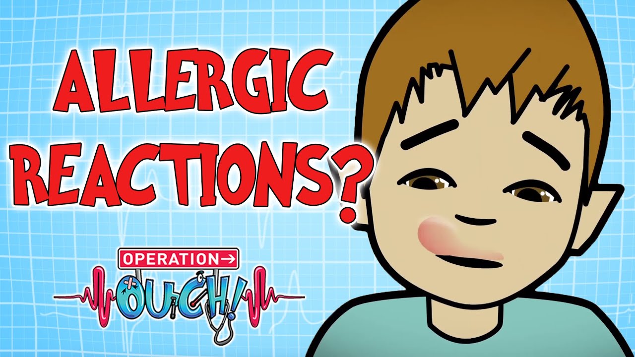What Are Allergic Reactions Operation Ouch Youtube