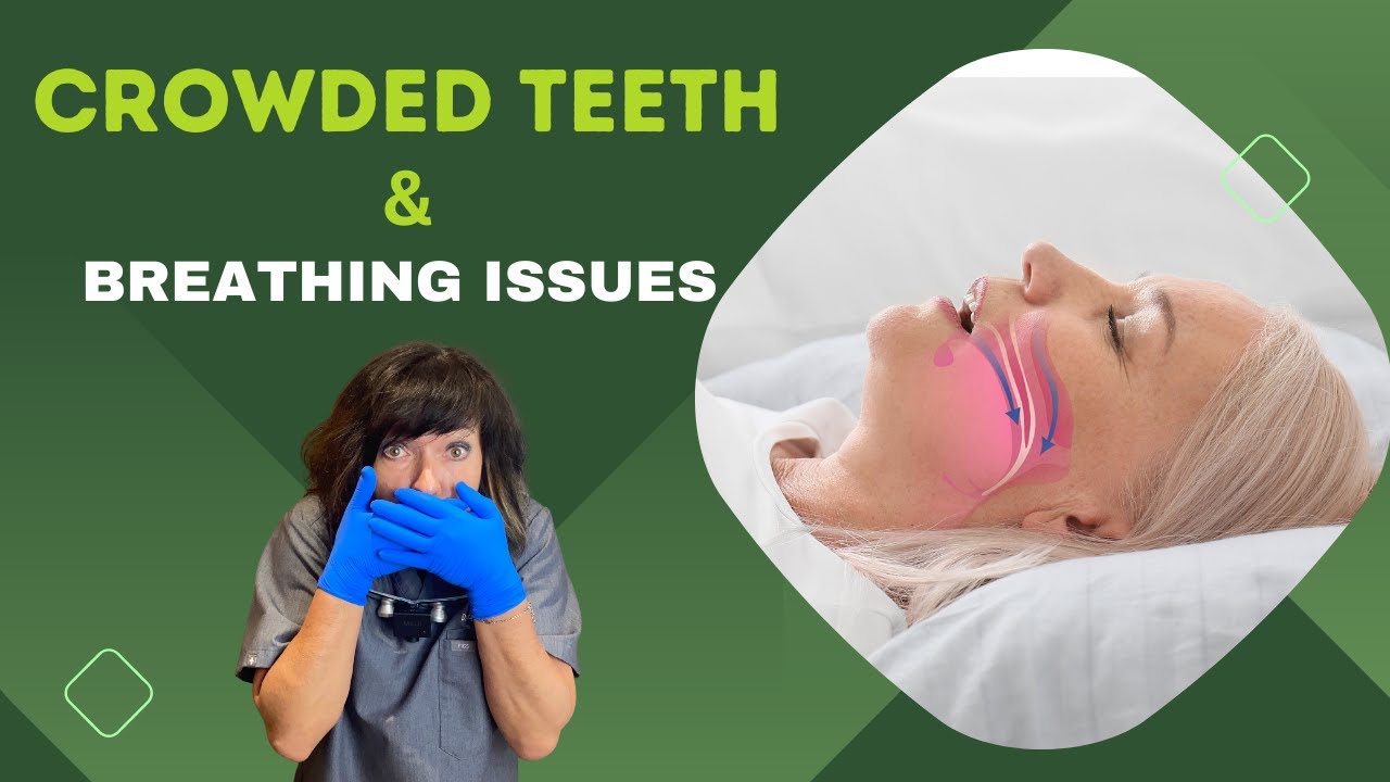 Crowded Teeth Breathing Issues Youtube