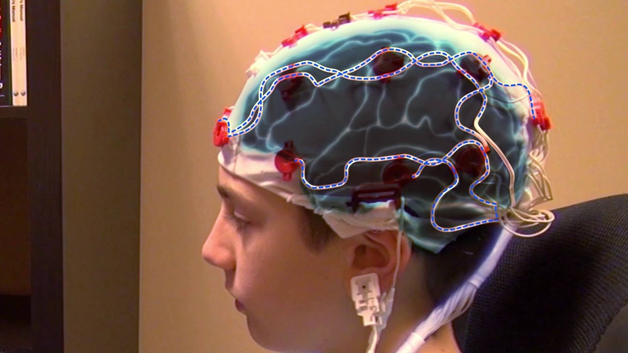 What Is Neurofeedback Youtube
