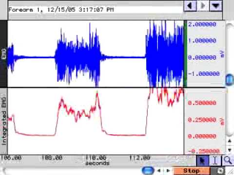 S01 Data Emg Biopac Science Lab Youtube